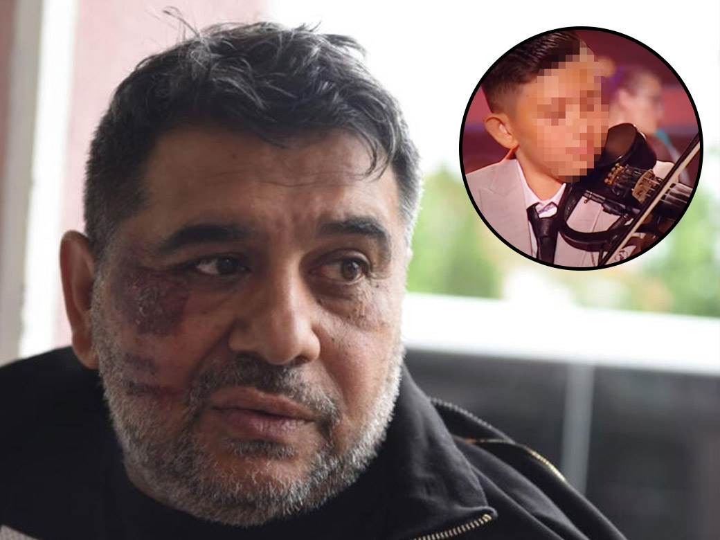 jovan vasic piromanac violinista doziveo nesrecu detalji | Mondo