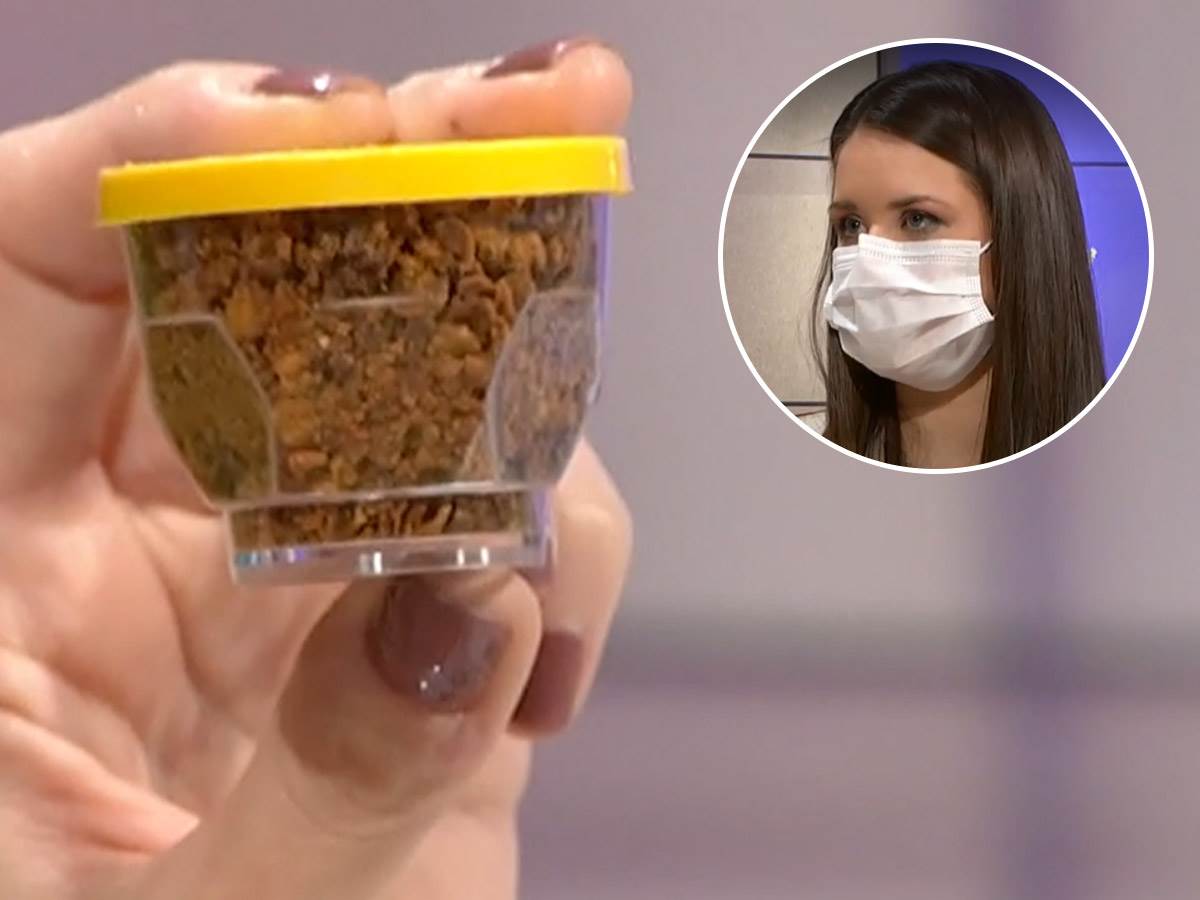 perga kao lek propolis med | Mondo