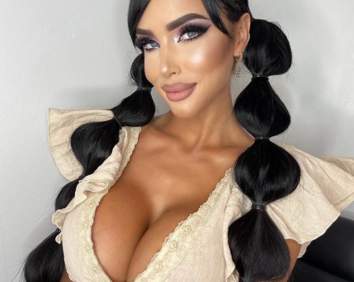 Aleksandra Subotić operacije pred ulazak u Zadrugu | Mondo