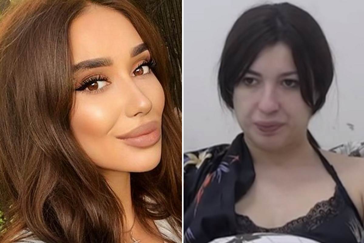 Rebeka Popović plastične operacije | Mondo