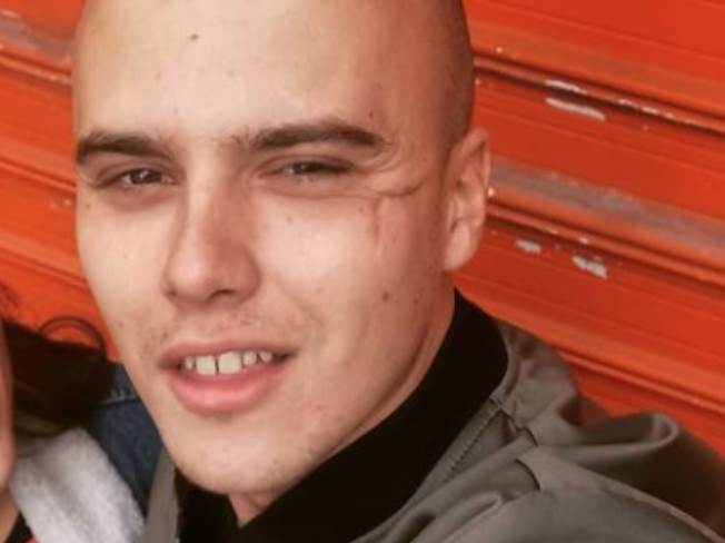 Miodrag Dragičević o ožiljku | Mondo