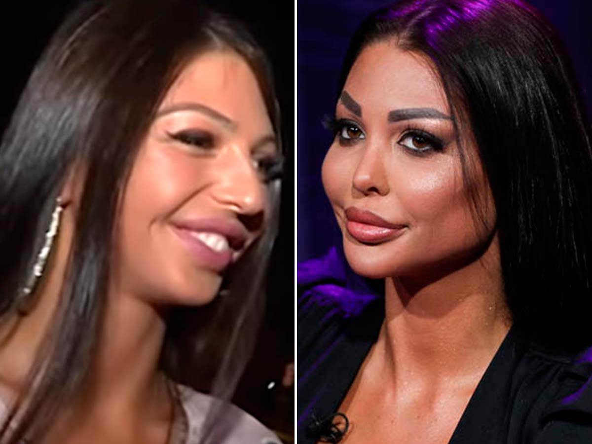 Maja Marinković plastične operacije slike pre i posle | Mondo