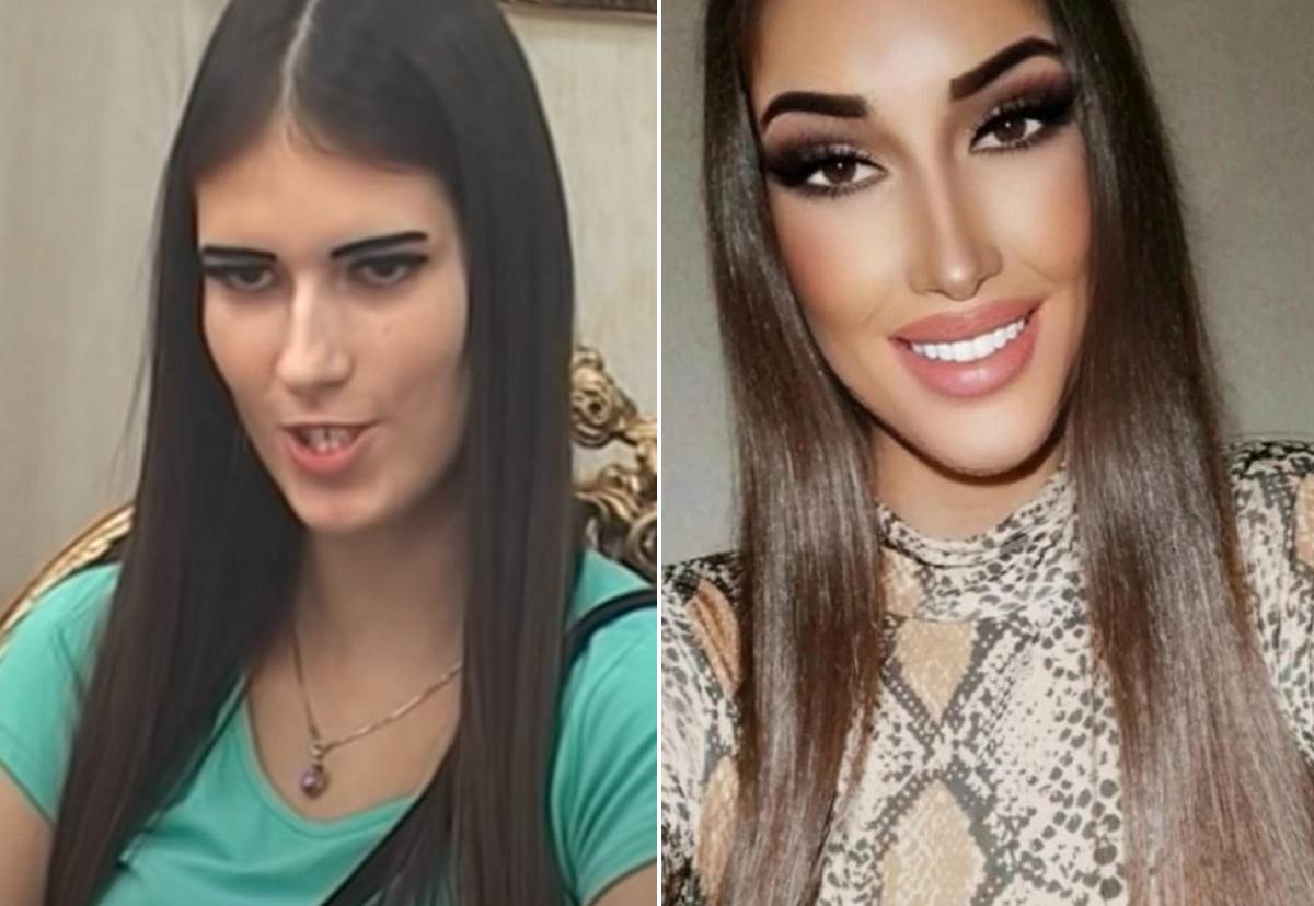 Sandra Meduza se operisala nove slike | Mondo