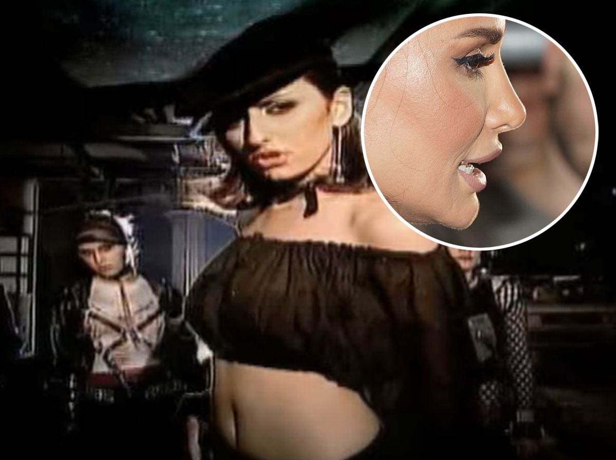 Emina Jahović pre i posle operacija | Mondo