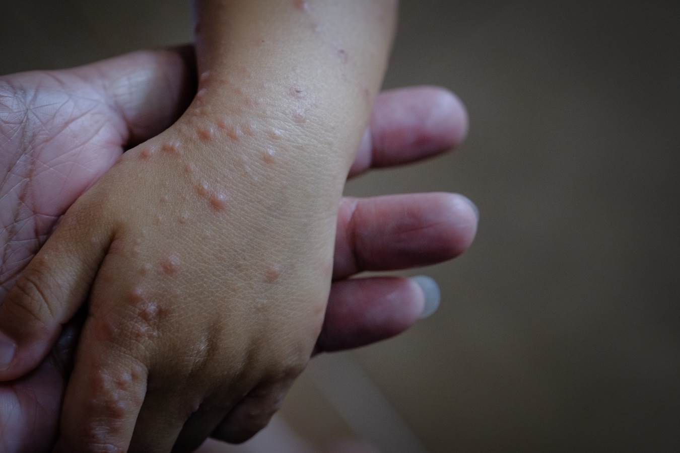 Simptomi virusa paradajz gripa | Mondo