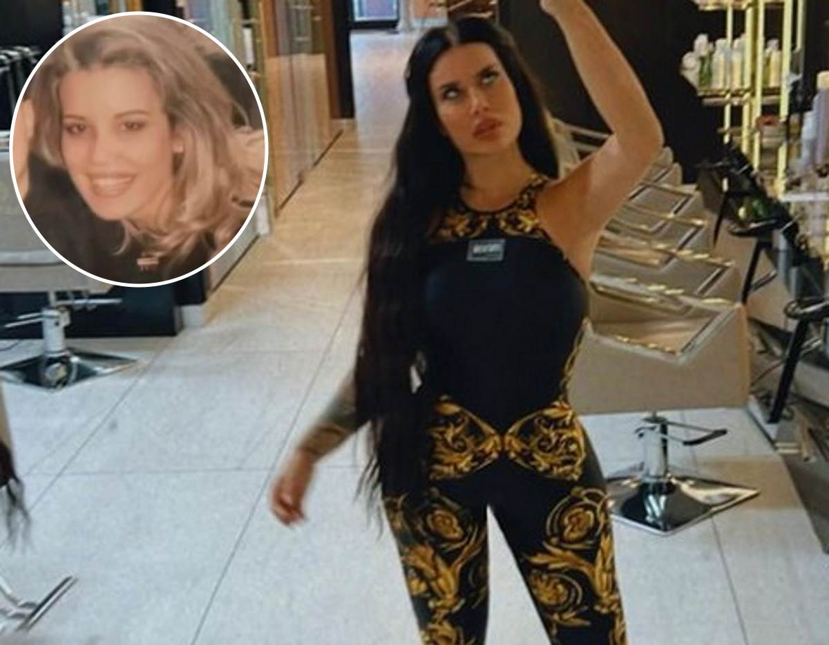 Alis Adaktar pre plastičnih operacija | Mondo