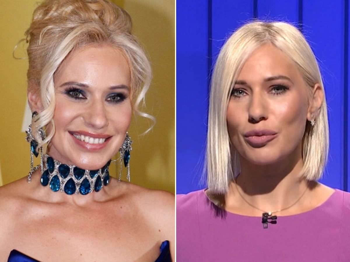 Marija Veljković o plastičnim operacijama | Mondo