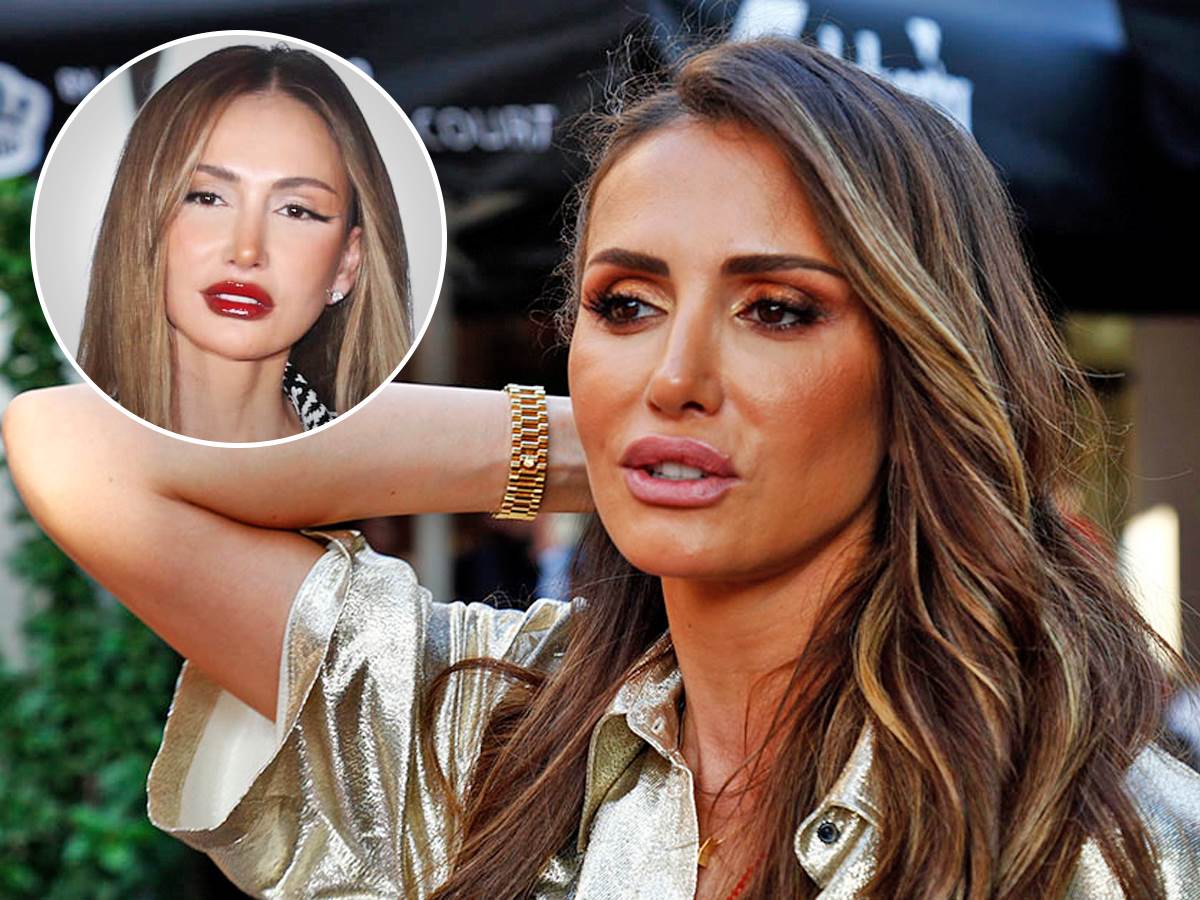 Emina Jahović pre operacija | Mondo