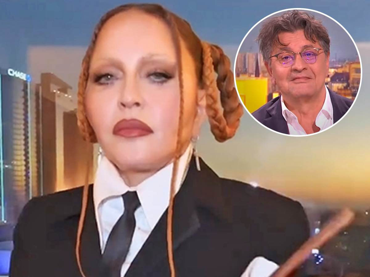 Dr Milan Colić o estetskoj hirurgiji kod Madone | Mondo