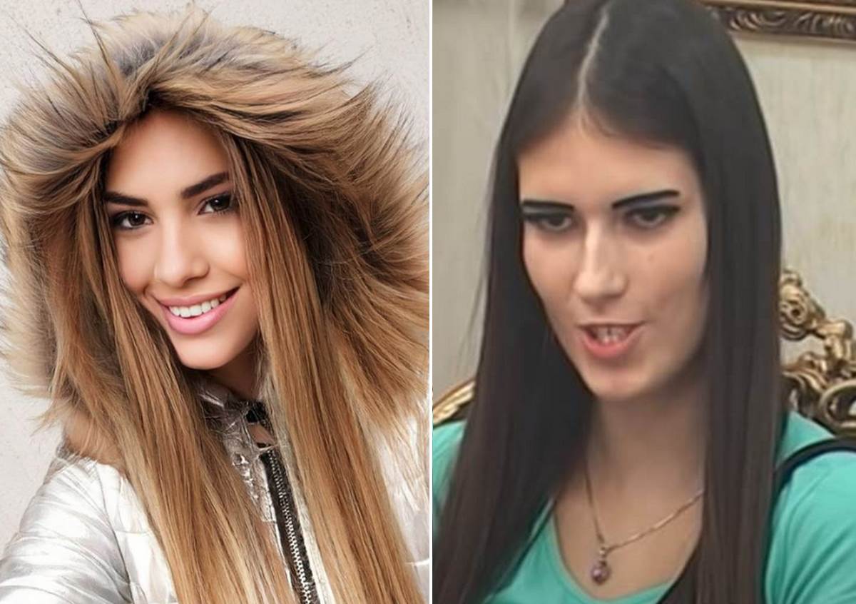 Sandra Meduza pre i posle | Mondo