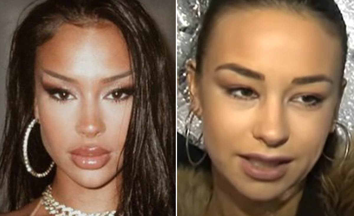 Elena Kitić pre i posle | Mondo