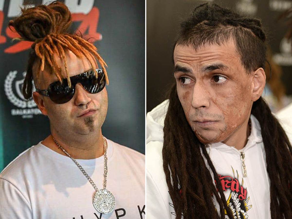 Rasta i Alen prekinuli saradnju | Mondo