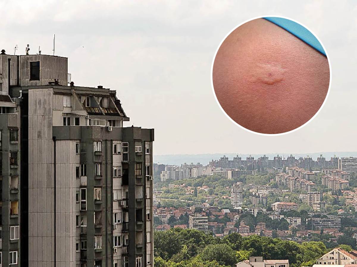 Srpkinju ujela buba klintonka, simptomi | Mondo