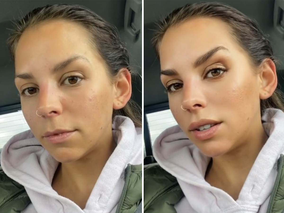 Devojka ima zaleđen osmeh posle botoksa | Mondo TV