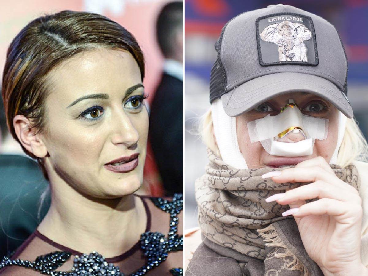 Dušica Jakovljević pre i posle plastičnih operacija | Mondo