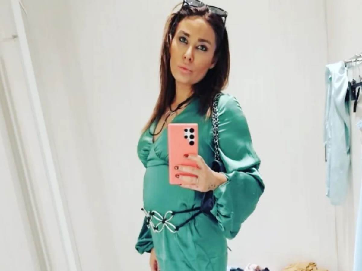 Ana Nikolić pokazala modrice na nogama | Mondo