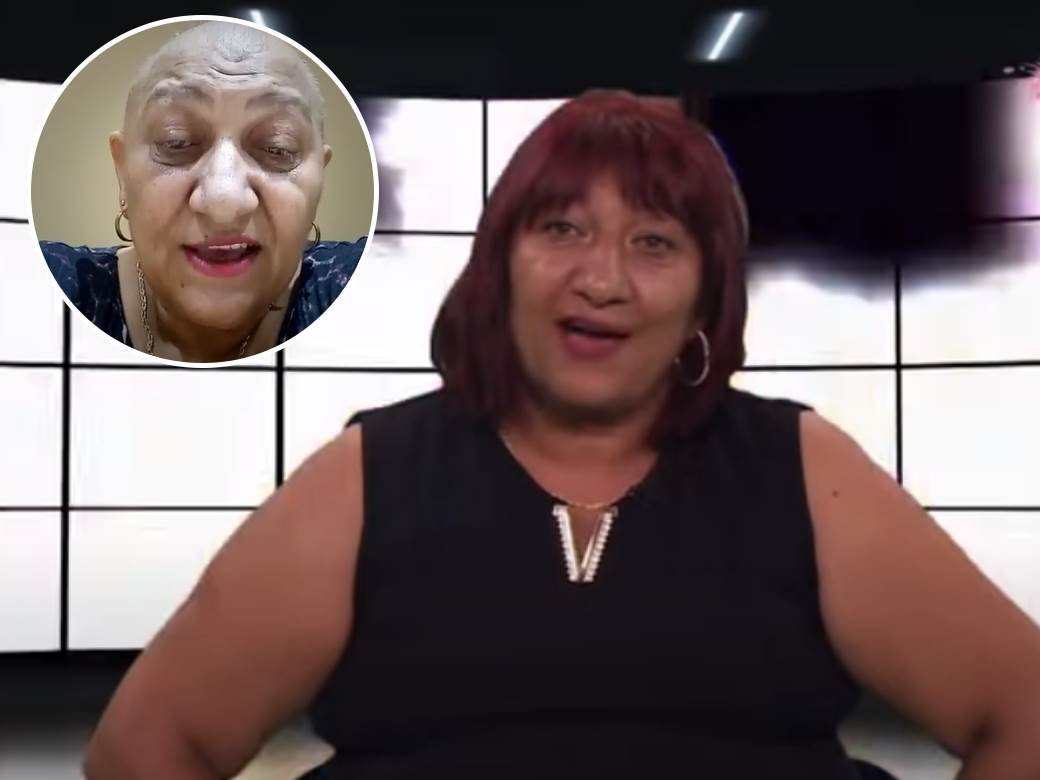 Rada Vasić bez kose u teškom stanju | Mondo