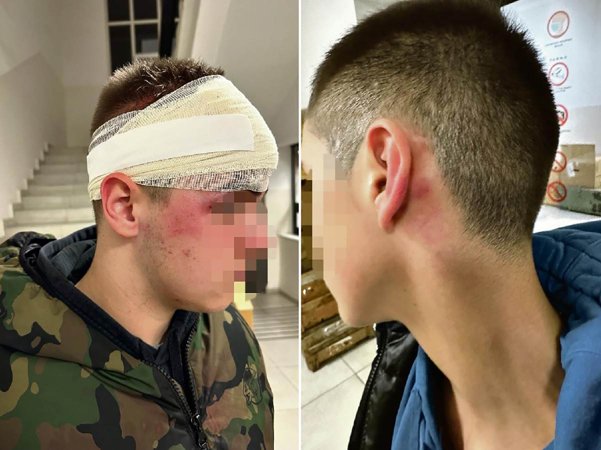 Maloletnici pretukli poznatog beogradskog lekara i njegove sinove | Mondo