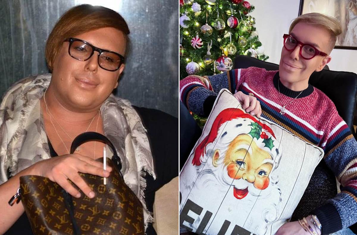 Boki 13 pre i posle | Mondo