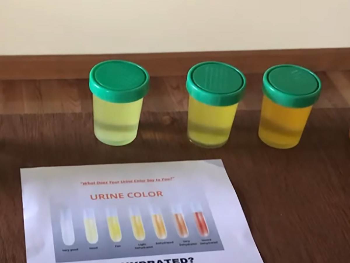 Koje boje treba da bude prvi jutarnji urin | Mondo