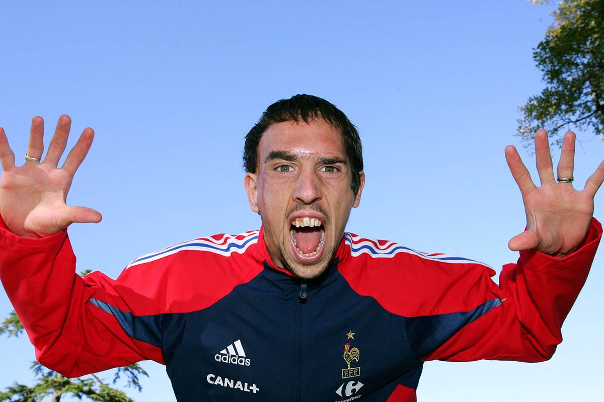 Frank Riberi ima ožiljke zbog kojih su ga zvali Kvazimodo | Mondo