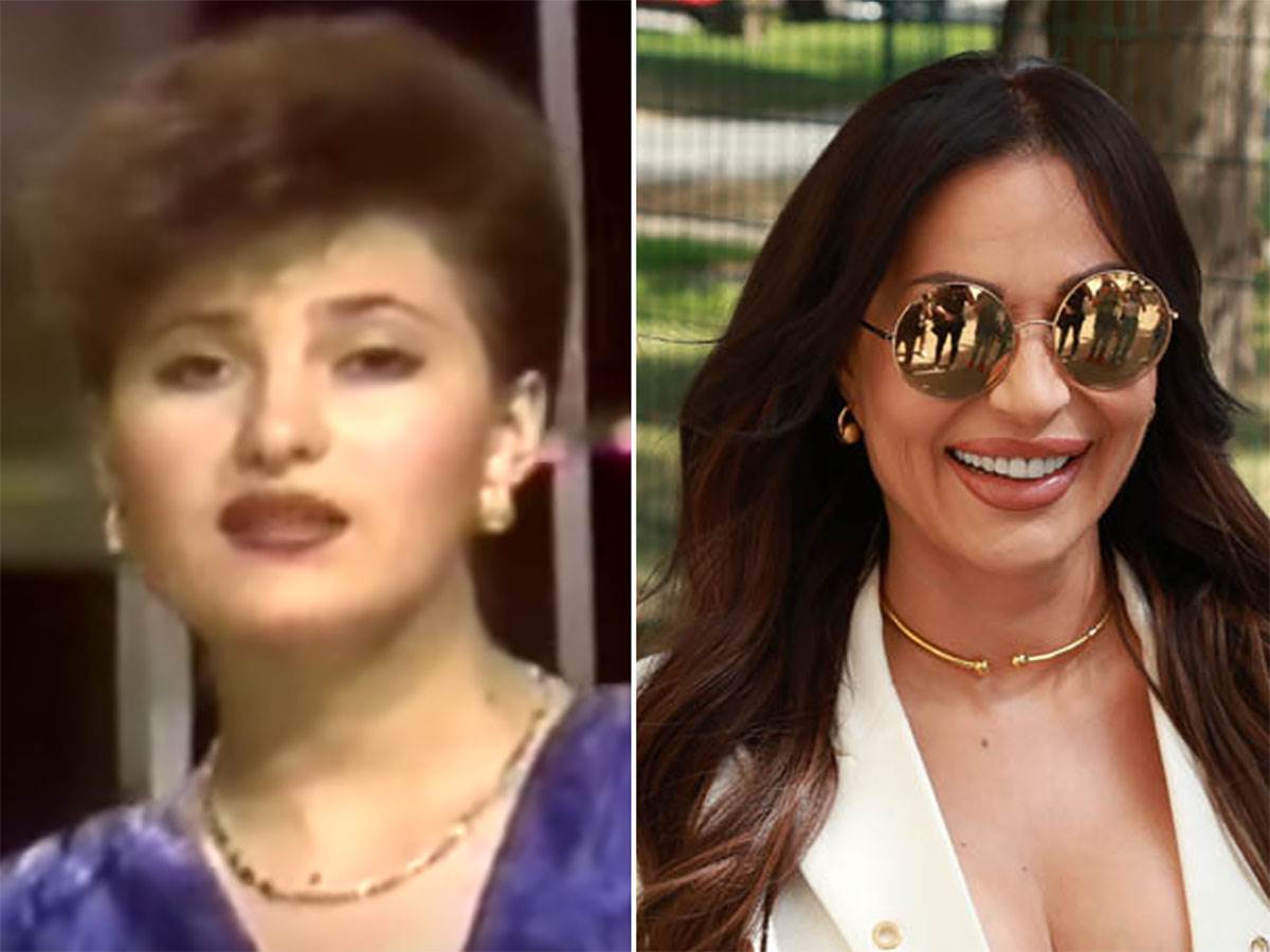 Ceca Ražnatović pre operacija | Mondo