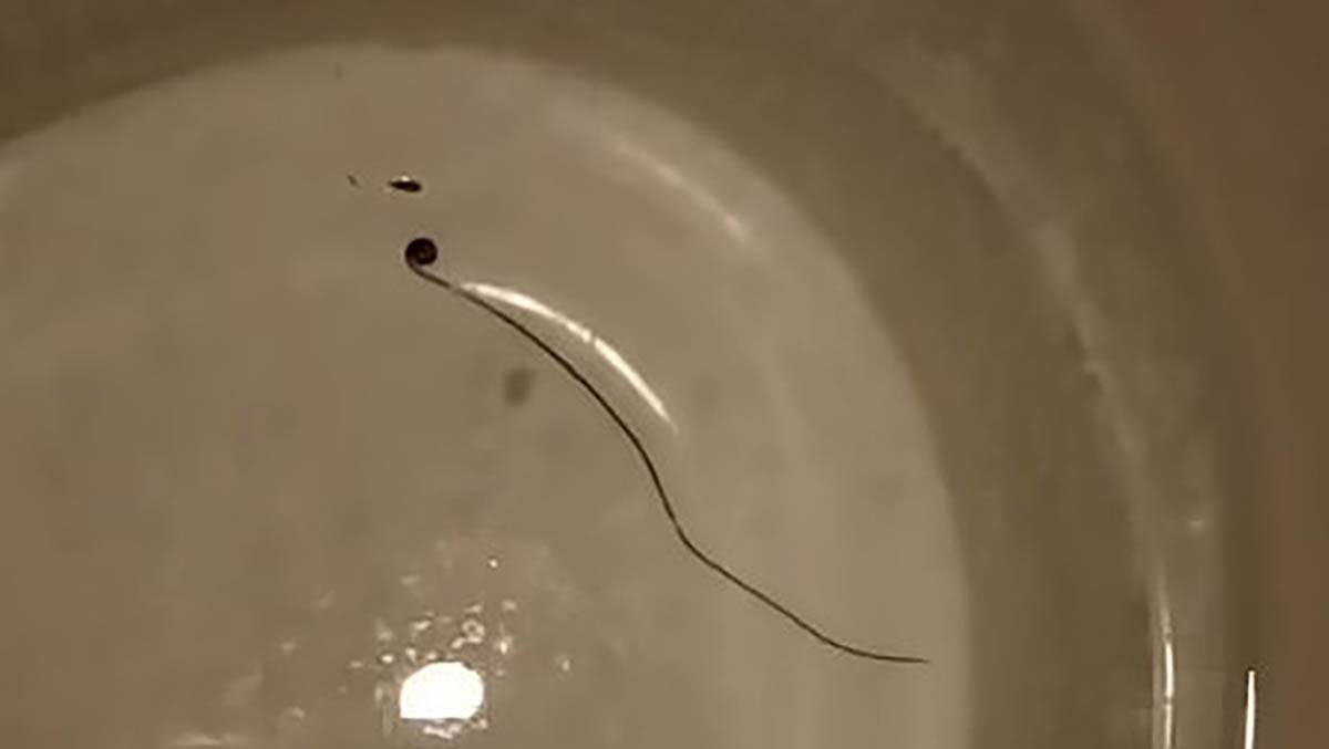 Parazit konjska dlaka u vodi za piće u Bujanovcu | Mondo