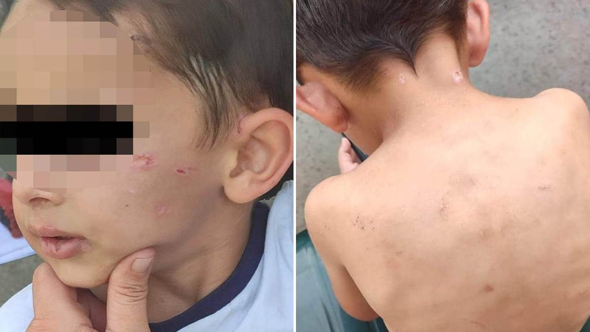 Otac iz Kovina gasio sinu cigarete po telu | Mondo