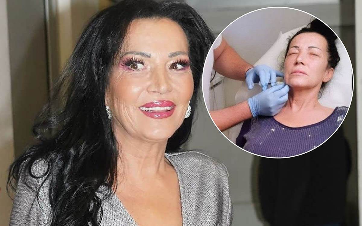 Goca Božinovska o botoksu | Mondo