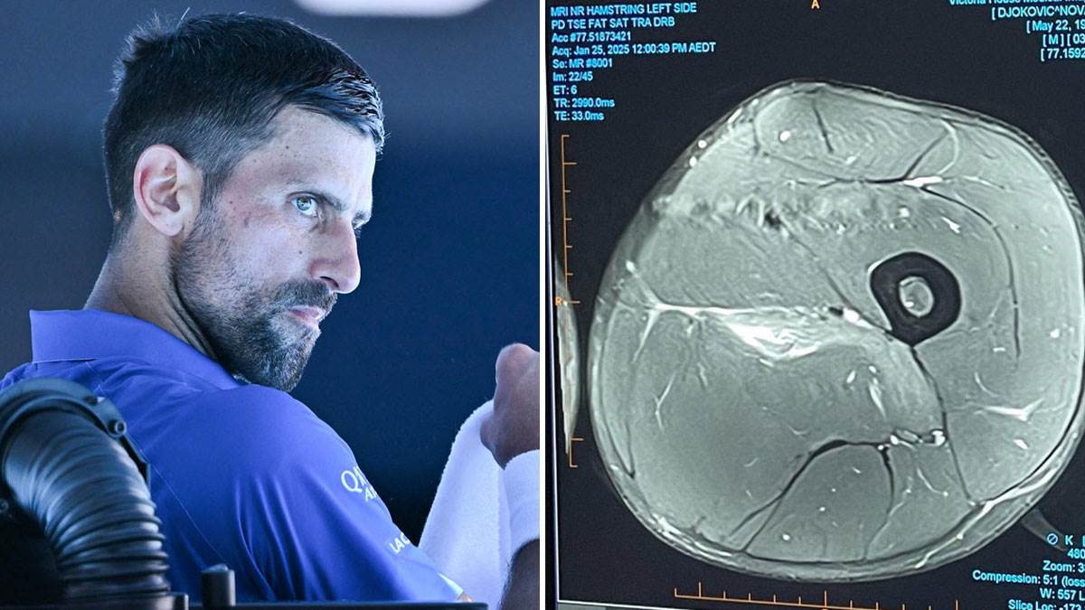 Novak Đoković na snimku skenera otkrio datume svih pregleda | Mondo