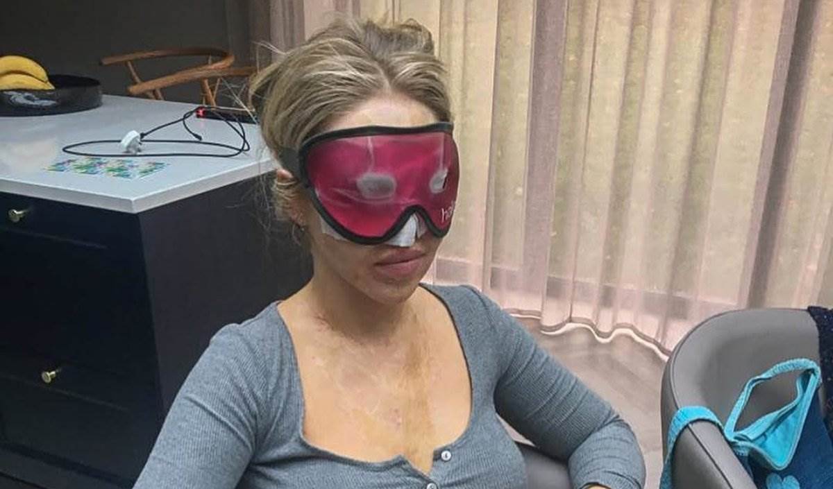 Lepa misica Kejti Pajper koju je Stefan polio kiselinom ostala bez oka ...