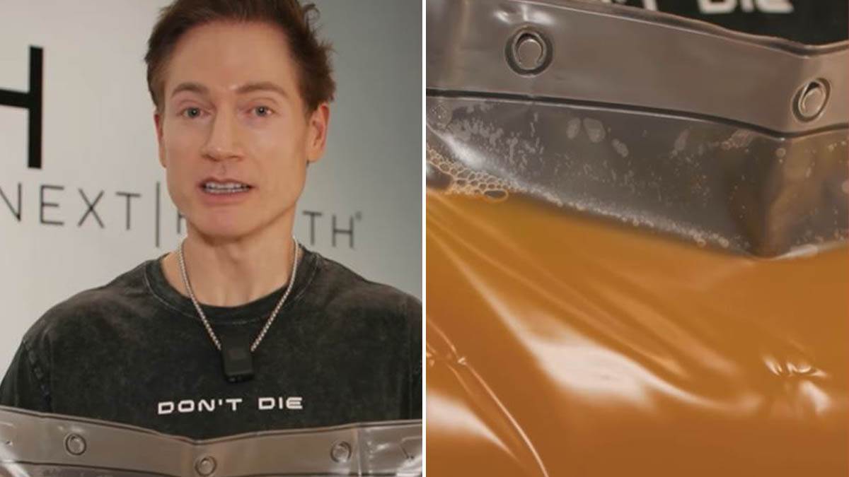 Milioner Brajan Džonson izvadio svu plazmu iz tela | Mondo