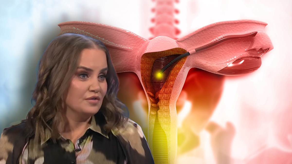 Simptomi mioma na materici koji ima Jelena Dokić | Mondo