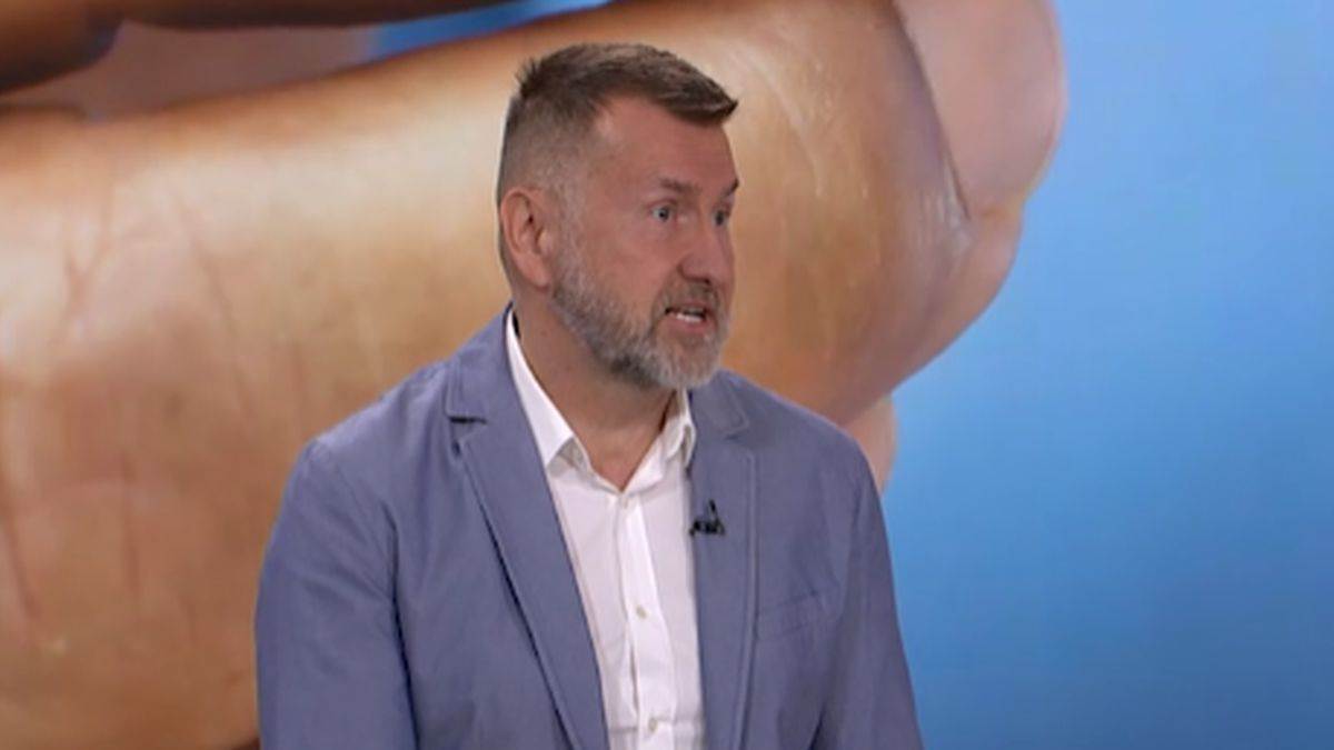 Dr Vladimir Janjić Simptomi Alchajmerove Bolesti Mondo
