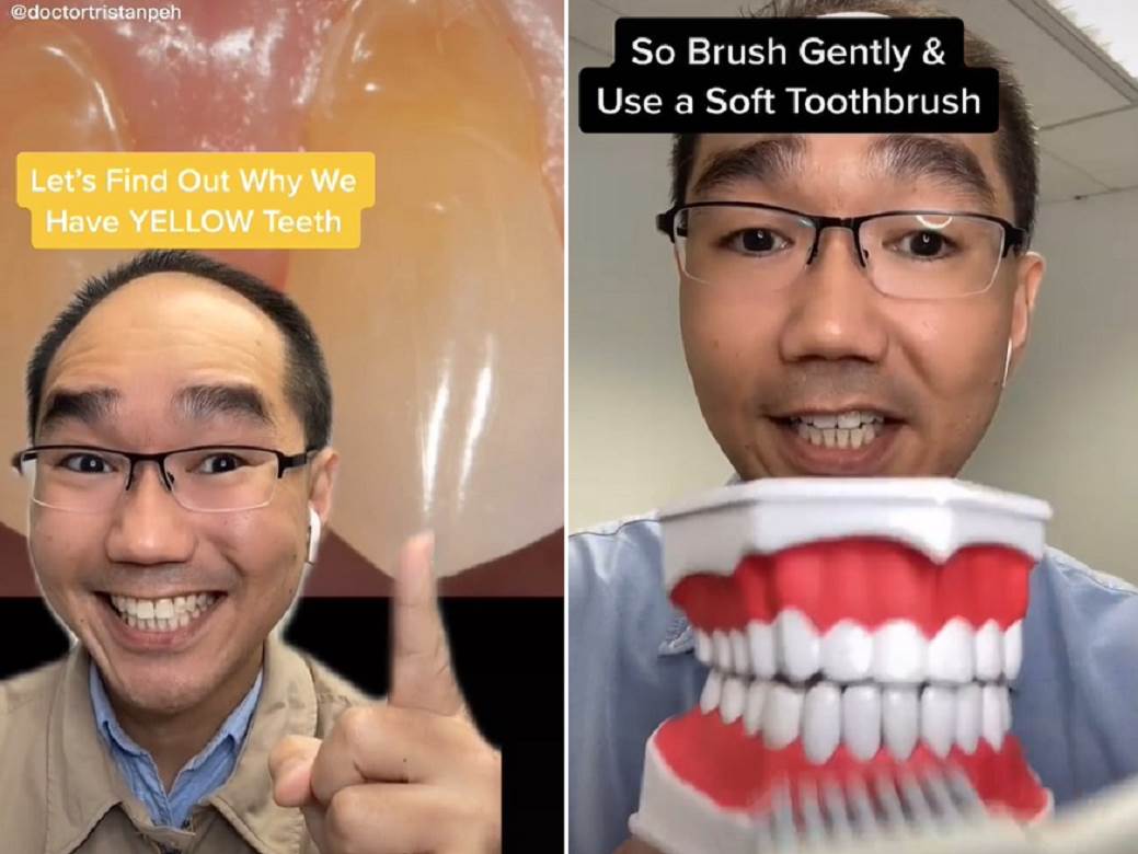 zuti zubi uzrok pranje zuba kako da zubi budu beli | Mondo